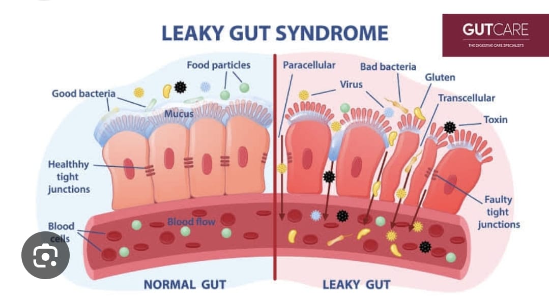 Understanding Leaky Gut Syndrome in Dogs: Causes, Symptoms, and Healing ...